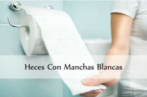Manchas blancas en las heces: causas y qué hacer (basados en la ...