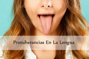 Protuberancias en la lengua: Causas y Tratamientos Naturales - NaturaleZax