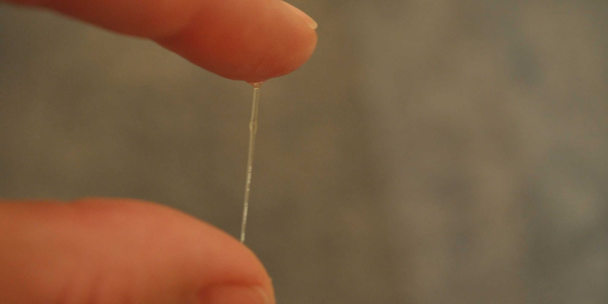 Tipos de moco: lo que el color de tu moco informa sobre tu salud ...